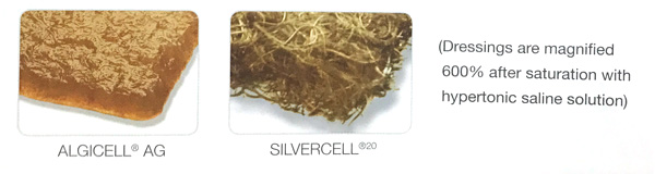 ALGICELL Ag protects wound dressing against bacterial colonization